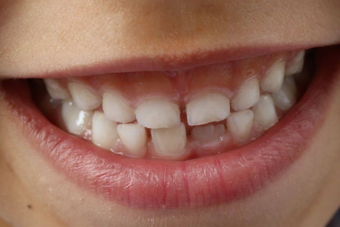 Your Child's Baby Teeth Could Be A Potential Cure